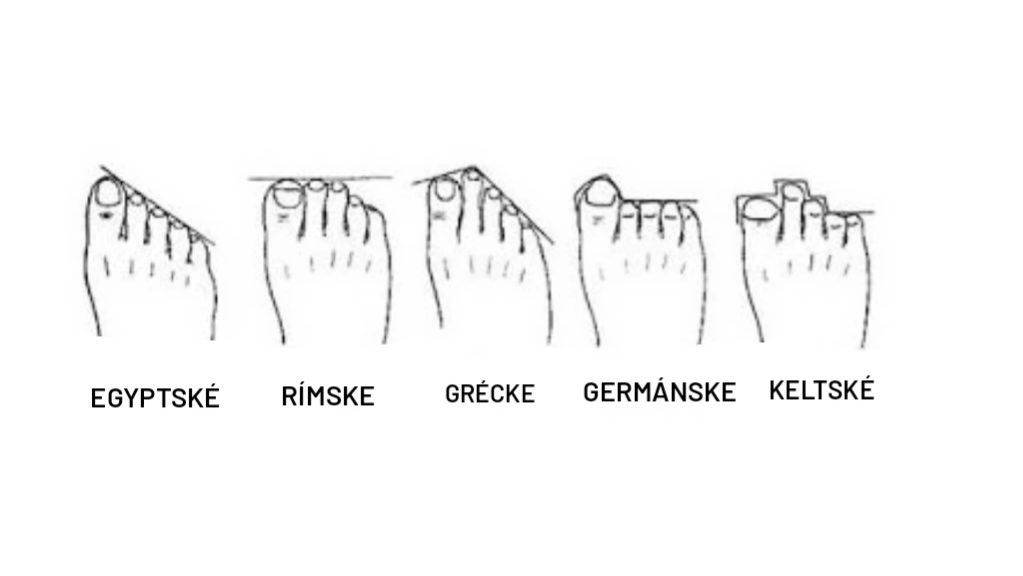 Jak si vybrat boty dle typu chodidla: řecké, egyptské, římské nebo ...